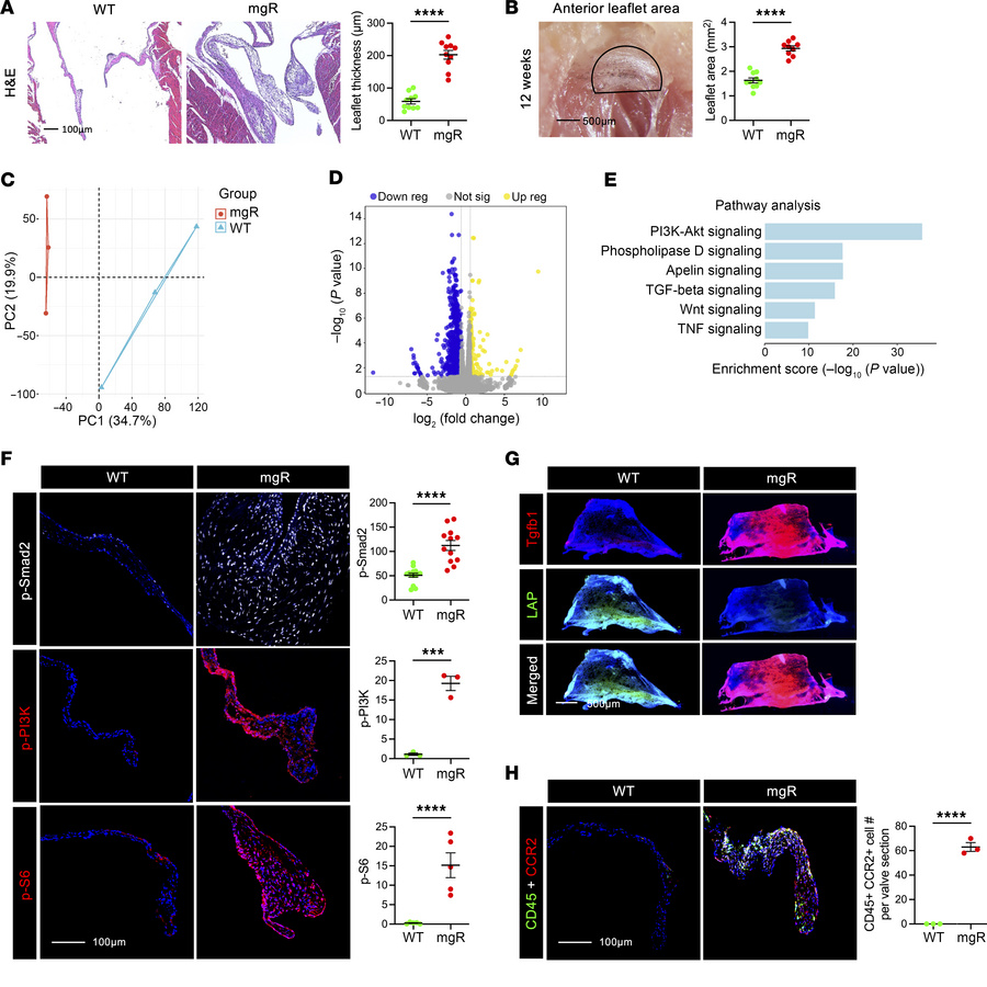 JCI - Integrin-mediated mTOR signaling drives TGF-β overactivity and ...