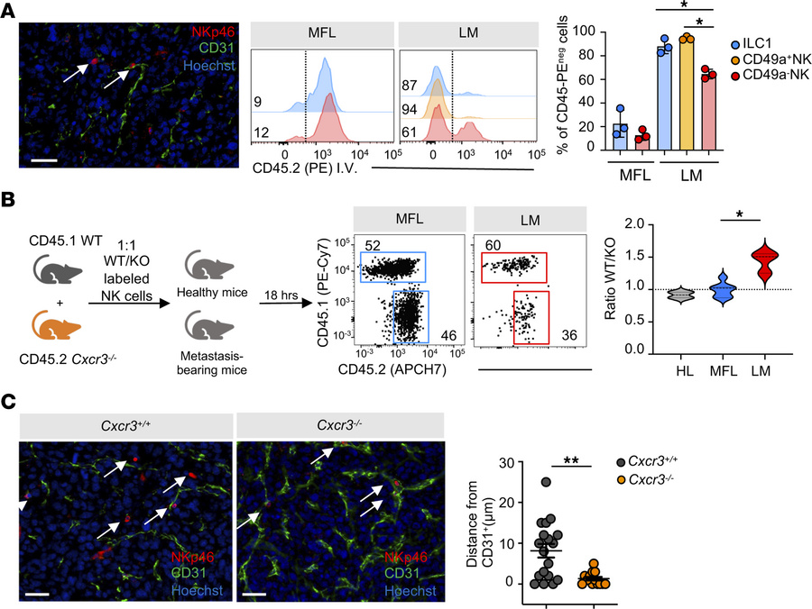 JCI - Cxcr3 promotes protection from colorectal cancer liver metastasis ...