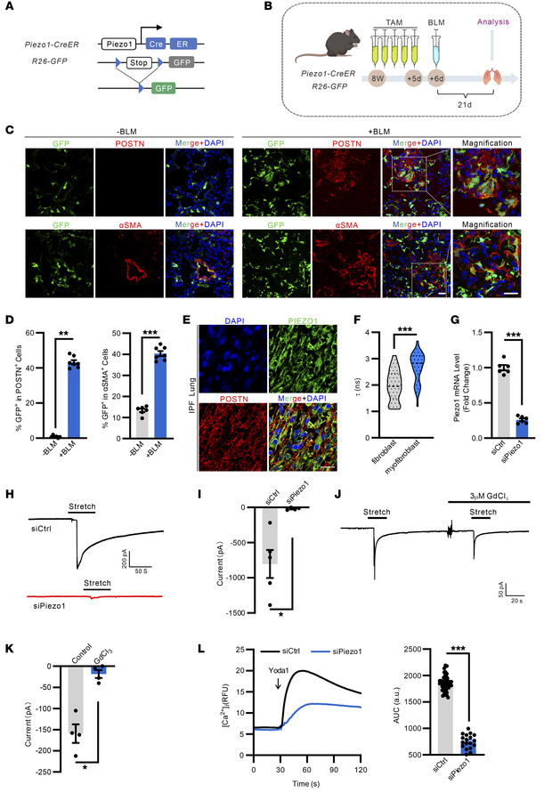 JCI - PIEZO1 mediates periostin+ myofibroblast activation and pulmonary ...