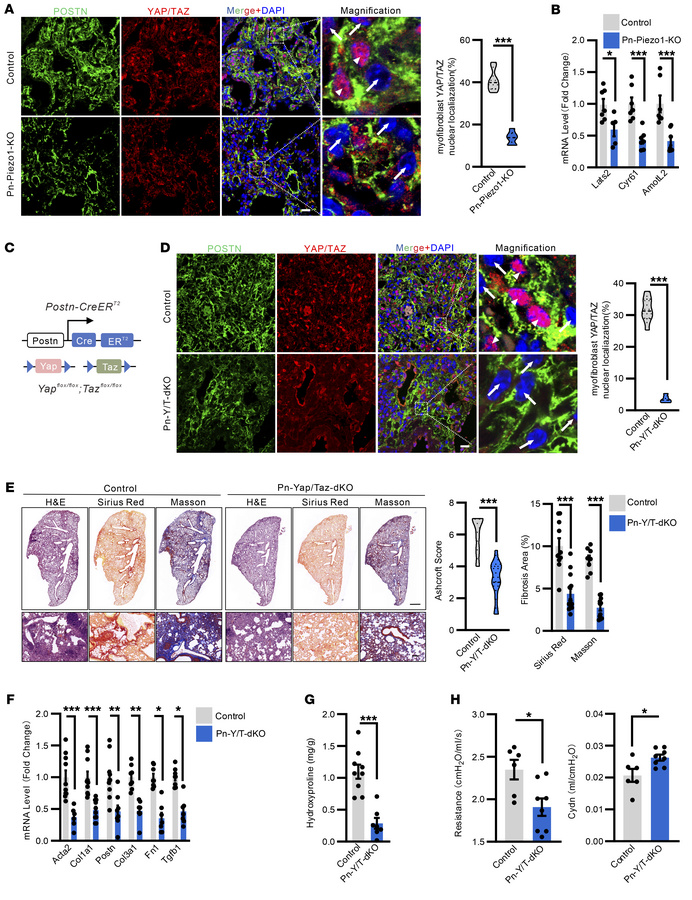 JCI - PIEZO1 mediates periostin+ myofibroblast activation and pulmonary ...