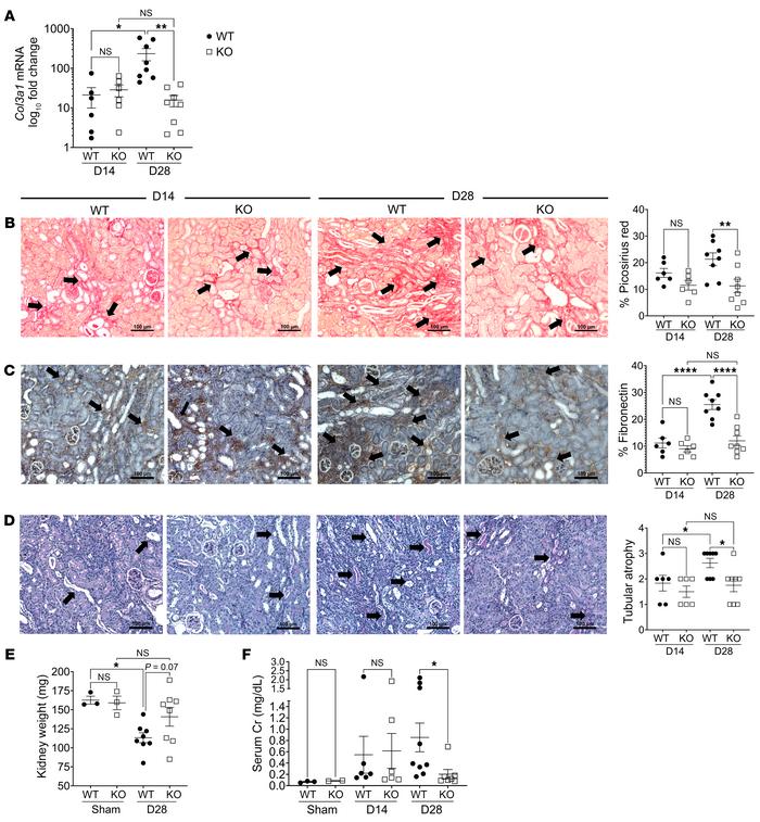 JCI - Targeting allograft inflammatory factor 1 reprograms kidney ...