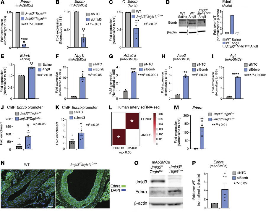 JCI - Epigenetic alteration of smooth muscle cells regulates endothelin ...