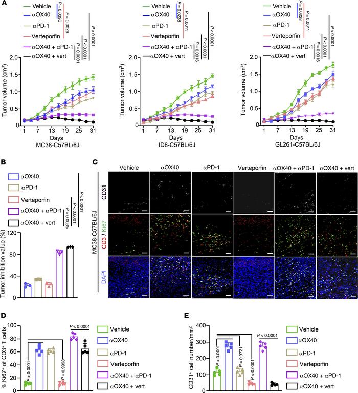 JCI - Endothelial OX40 activation facilitates tumor cell escape from T ...