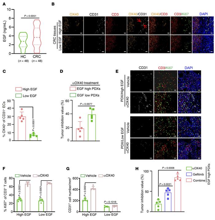 JCI - Endothelial OX40 activation facilitates tumor cell escape from T ...