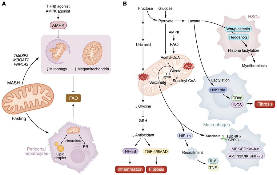 JCI - MASH: the nexus of metabolism, inflammation, and fibrosis