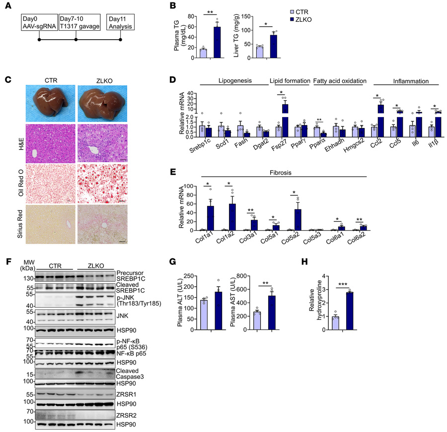 JCI - Disrupted minor intron splicing activates reductive carboxylation ...