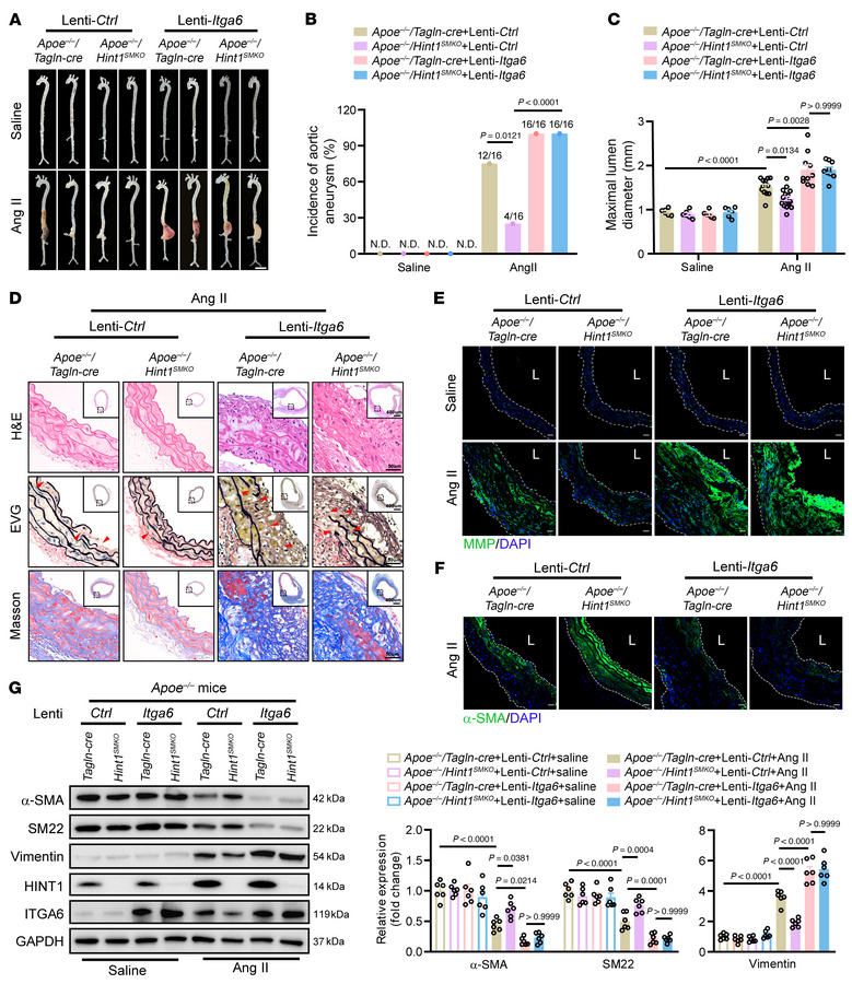 JCI - HINT1 aggravates aortic aneurysm by targeting ITGA6/FAK axis in ...