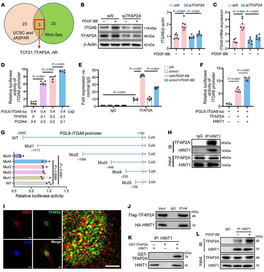JCI - HINT1 aggravates aortic aneurysm by targeting ITGA6/FAK axis in ...
