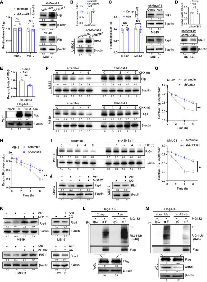 JCI - Asparagine drives immune evasion in bladder cancer via RIG-I ...