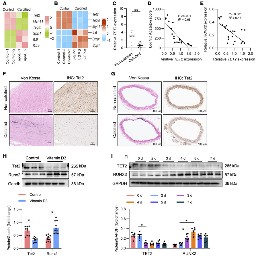 JCI - TET2 suppresses vascular calcification by forming an inhibitory ...