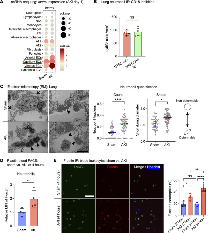 JCI - Acute kidney injury triggers hypoxemia by lung intravascular ...