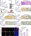 JCI - ST6GalNAc-I regulates tumor cell sialylation via NECTIN2/MUC5AC ...