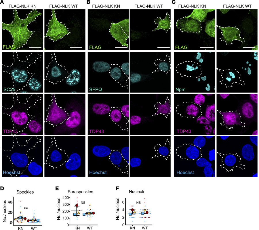 JCI - Nemo-like kinase disrupts nuclear import and drives TDP43 ...