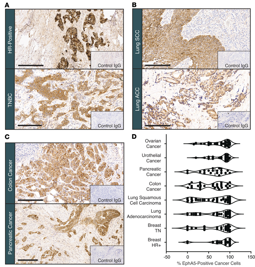 JCI - First-generation and preclinical evaluation of an EphA5-targeted ...