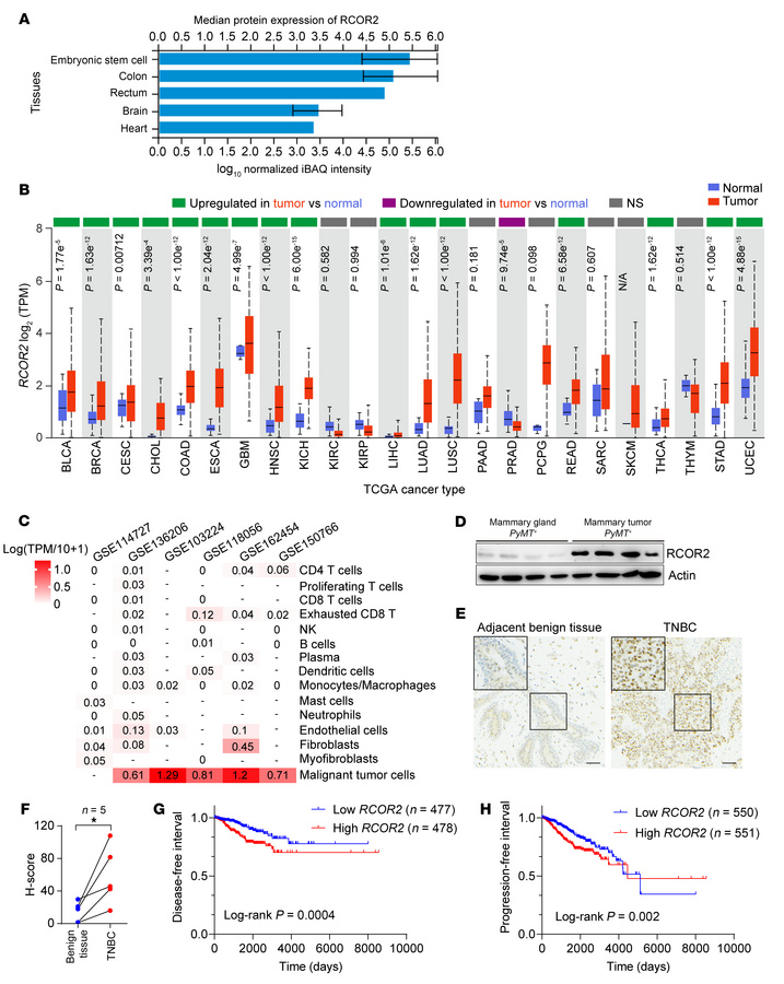 JCI - Tumoral RCOR2 promotes tumor development through dual epigenetic ...