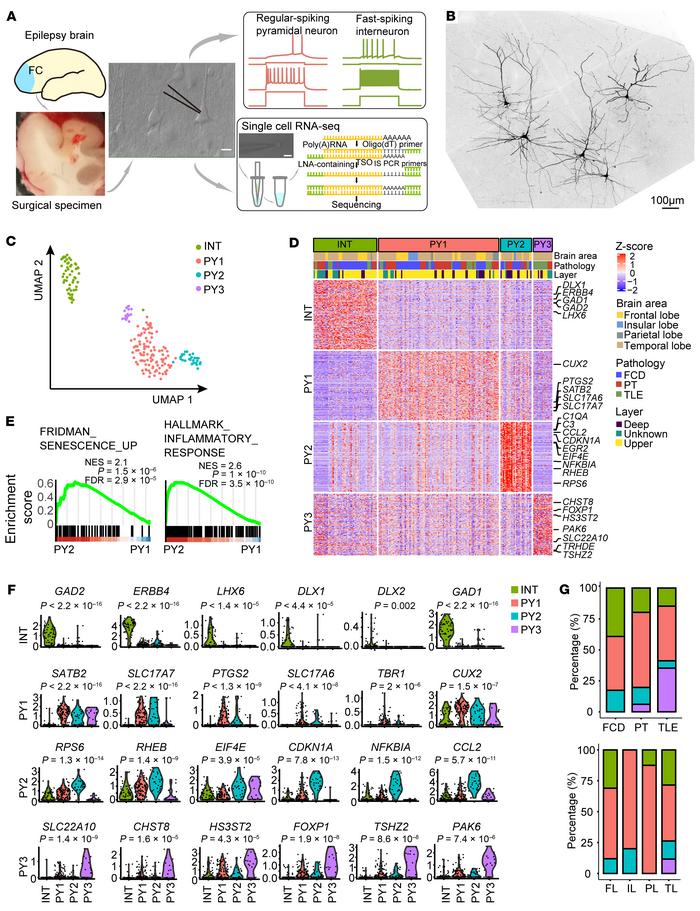 JCI - Multimodal single-cell analyses reveal molecular markers of ...