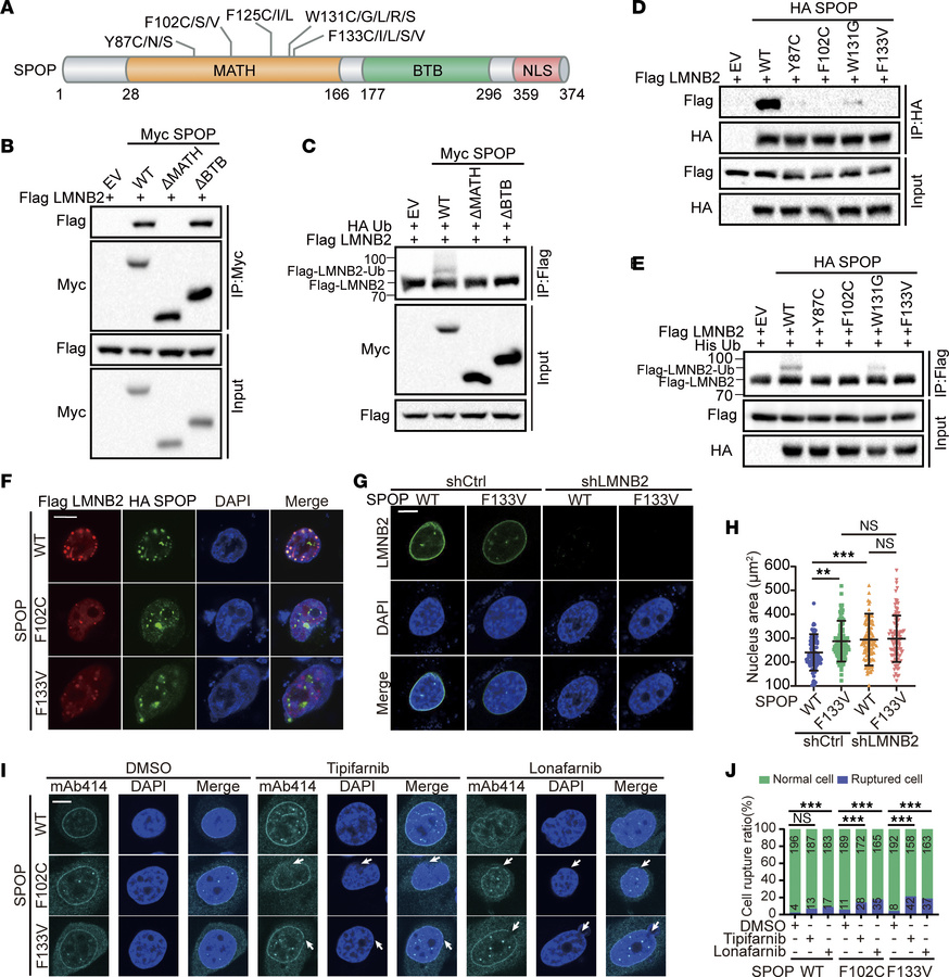 JCI - Cancer-associated SPOP mutations enlarge nuclear size and ...
