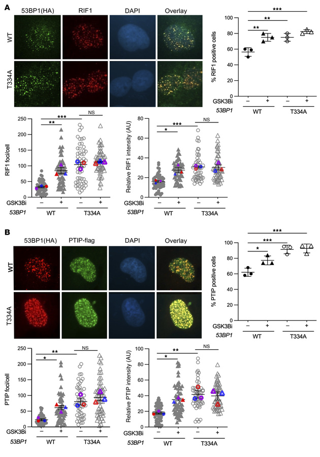 JCI - GSK3B directs DNA repair choice and determines tumor response to ...
