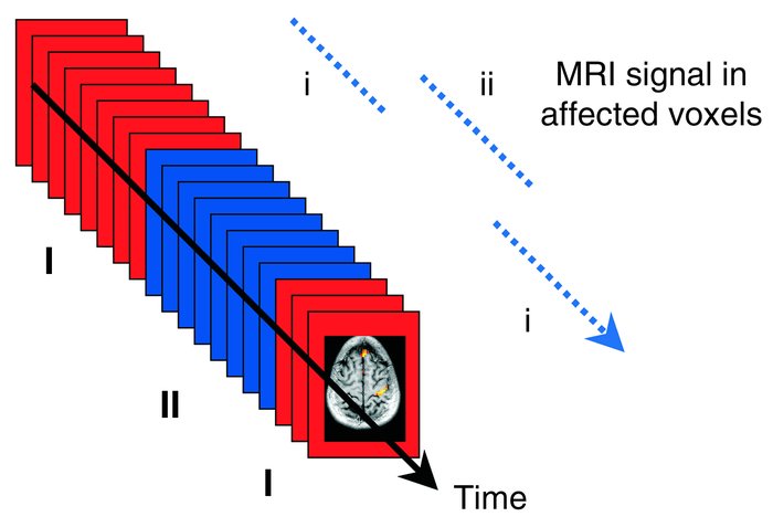 JCI - Principles and practice of functional MRI of the human brain