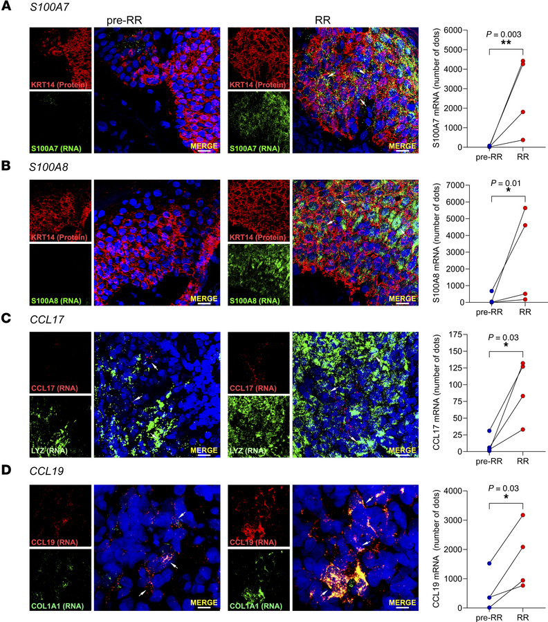 JCI - Dynamics of Th1/Th17 responses and antimicrobial pathways in ...