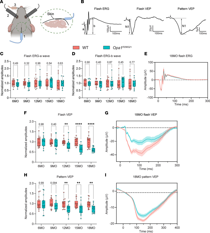 JCI - SARM1 loss protects retinal ganglion cells in a mouse model of ...