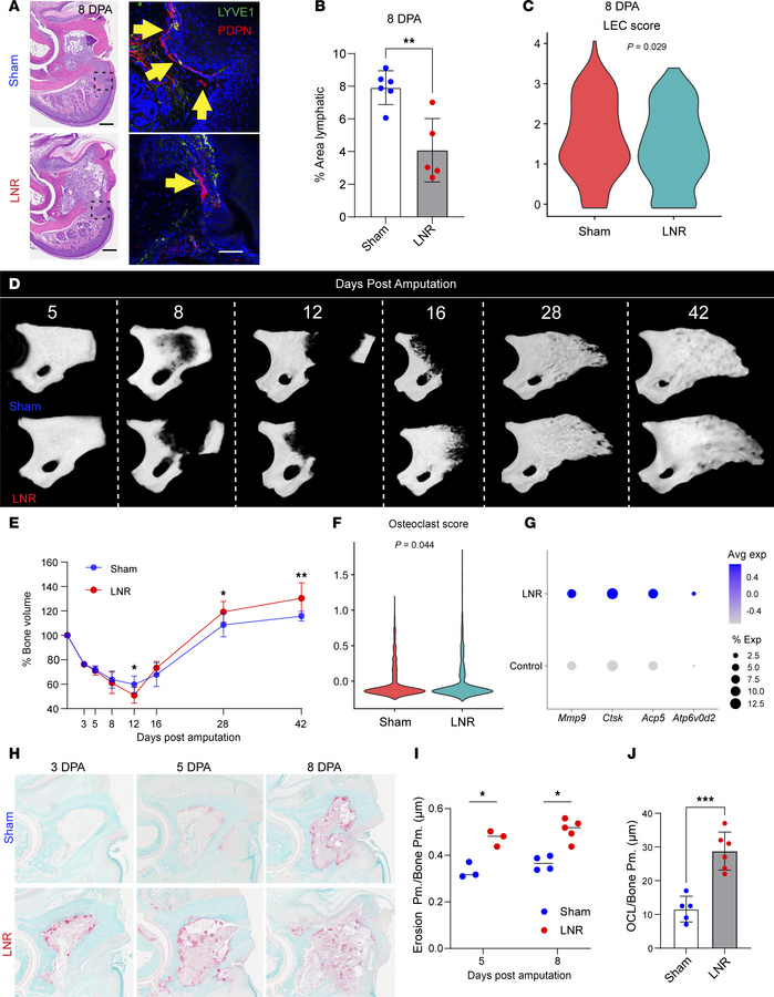 JCI - Targeting lymphatic vessels enhances bone regeneration by ...