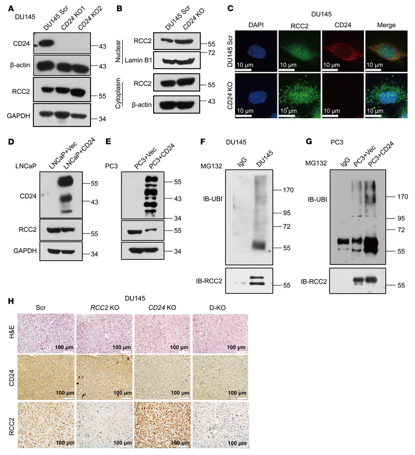 JCI - RCC2 and CD24 cooperate to modulate prostate cancer progression ...