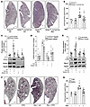 JCI - Macropinocytosis inhibition attenuates profibrotic responses in ...