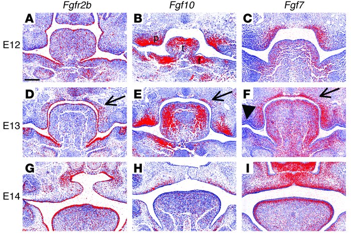 JCI - Disruption of Fgf10/Fgfr2b-coordinated epithelial-mesenchymal ...