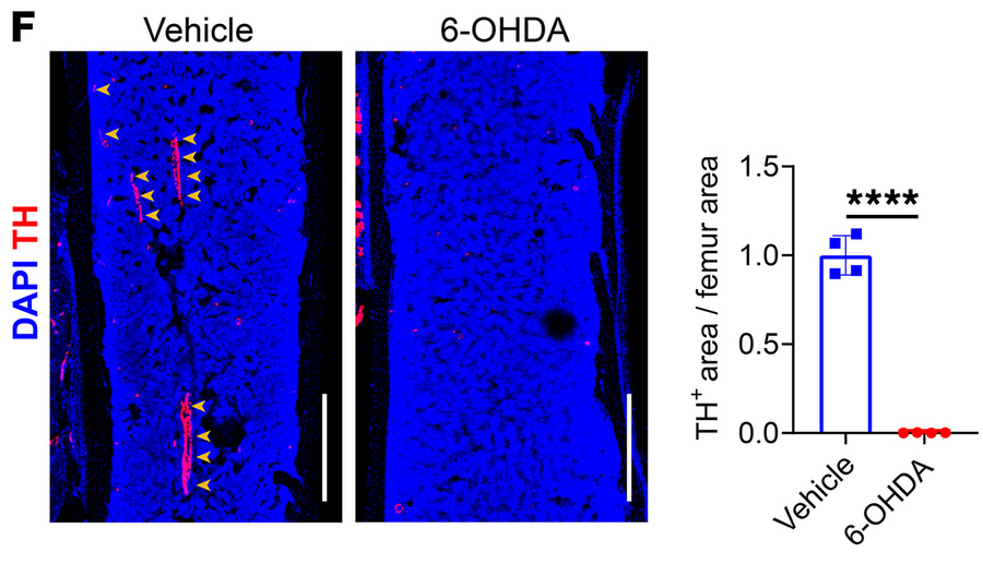 JCI - Corrigendum to Axon guidance cue SLIT2 regulates the murine ...