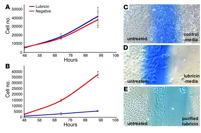 JCI - The secreted glycoprotein lubricin protects cartilage surfaces ...