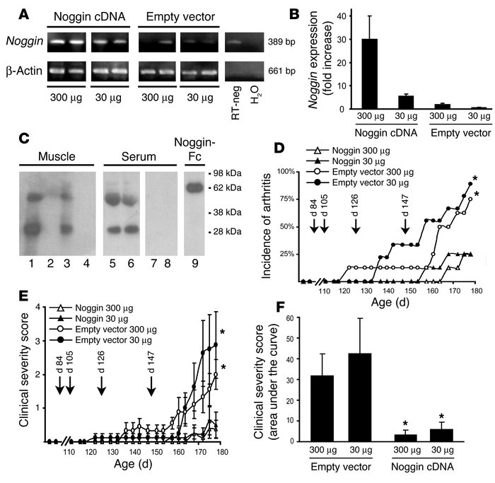 JCI - Modulation of bone morphogenetic protein signaling inhibits the ...
