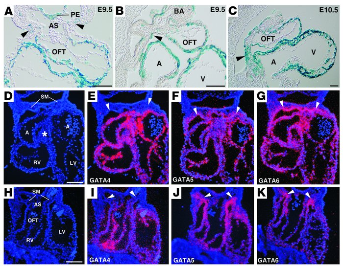 JCI - Morphogenesis of the right ventricle requires myocardial ...