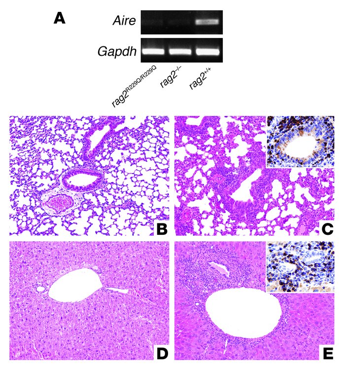 JCI - A hypomorphic R229Q Rag2 mouse mutant recapitulates human Omenn ...