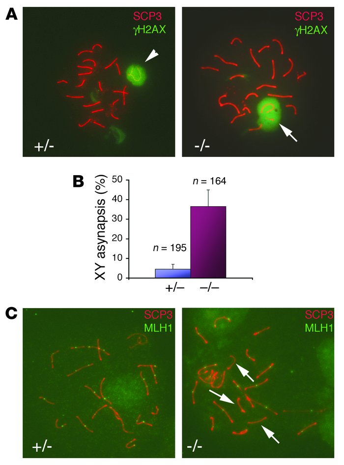 JCI - Ewing sarcoma gene EWS is essential for meiosis and B lymphocyte ...