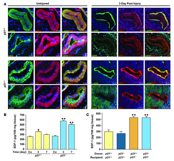JCI - p21Cip1 modulates arterial wound repair through the stromal cell ...