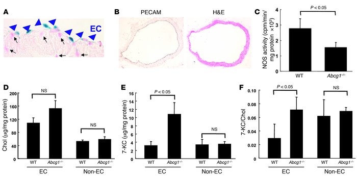 JCI - ABCG1 and HDL protect against endothelial dysfunction in mice fed ...