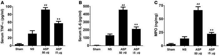 JCI - A complement-dependent balance between hepatic ischemia ...