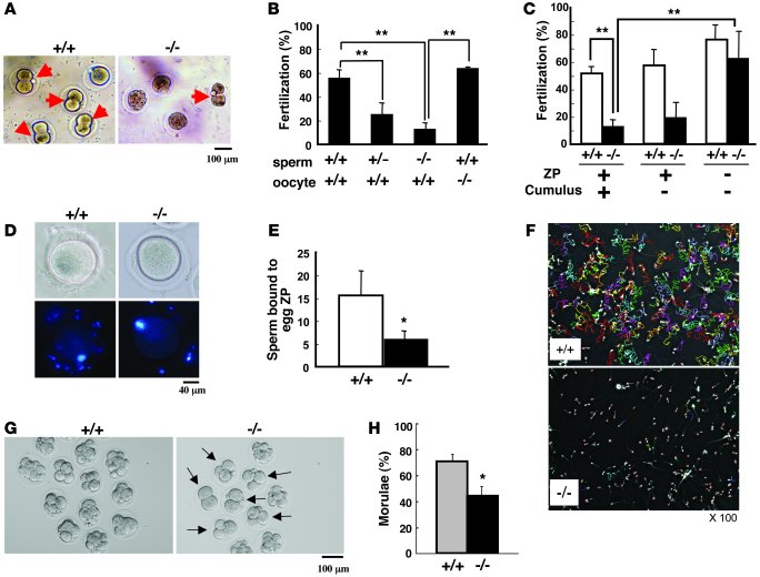 JCI - Group III secreted phospholipase A2 regulates epididymal sperm ...