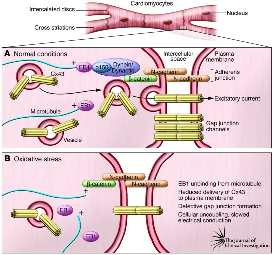JCI Oxidant Stress Derails The Cardiac Connexon Connection JCI Oxidant Stress Derails The Cardiac Connexon Connection
