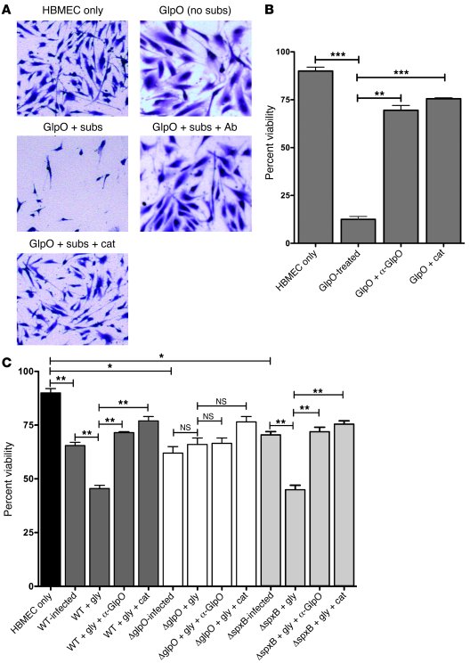 JCI - Identification of a novel pneumococcal vaccine antigen ...
