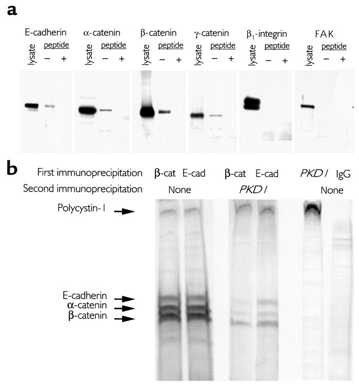JCI - Polycystin-1, the PKD1 gene product, is in a complex containing E ...