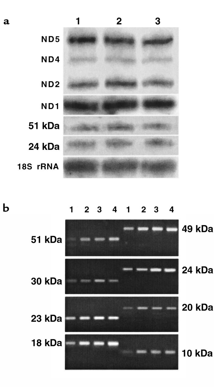 JCI - Nuclear DNA origin of mitochondrial complex I deficiency in fatal ...