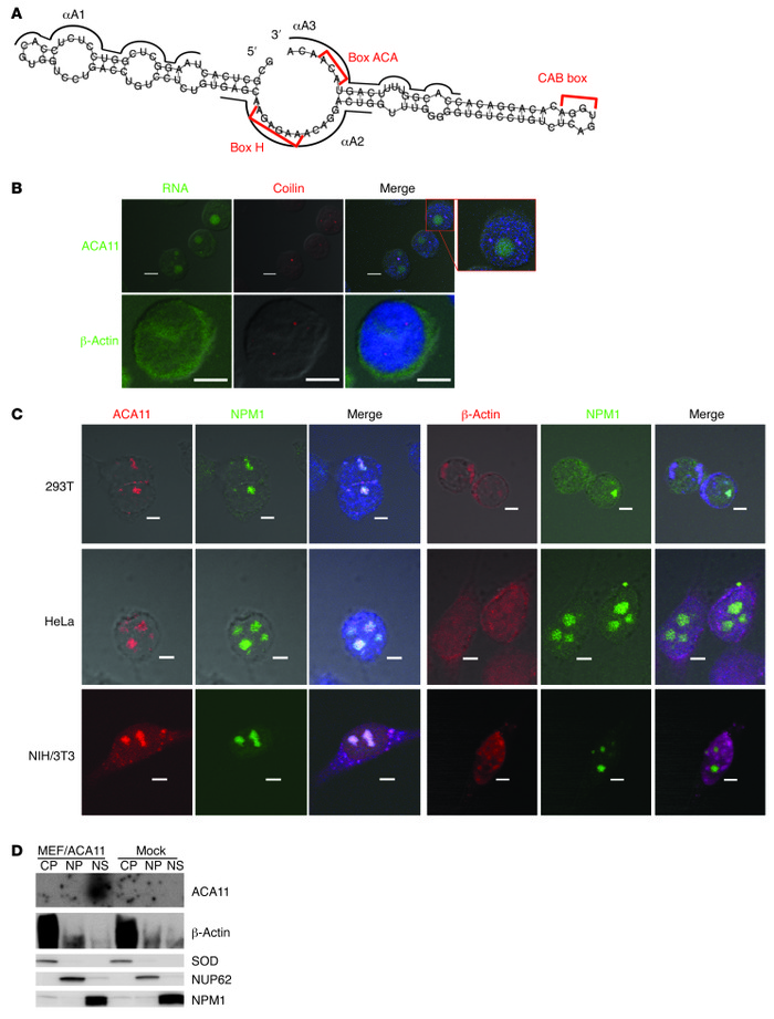 JCI - Multiple myeloma–associated chromosomal translocation activates ...