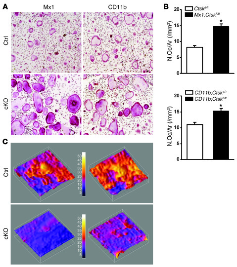 JCI - Osteoclast-specific cathepsin K deletion stimulates S1P-dependent ...