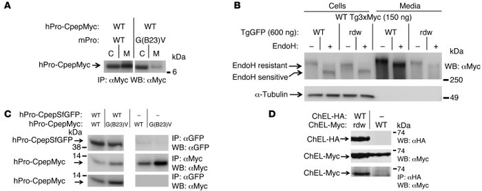 JCI - Dominant protein interactions that influence the pathogenesis of ...