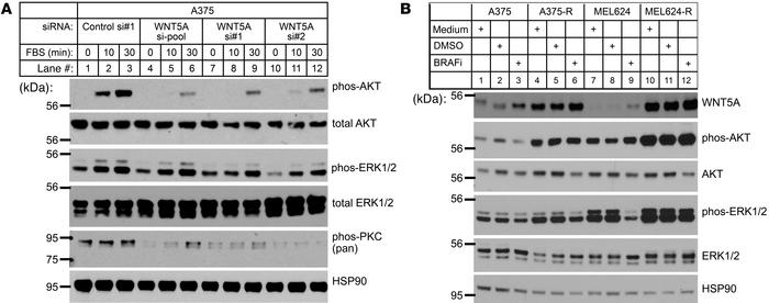 JCI - WNT5A enhances resistance of melanoma cells to targeted BRAF ...