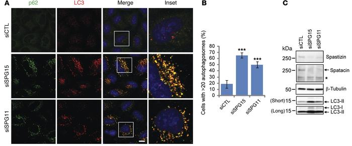 JCI - Spastic paraplegia proteins spastizin and spatacsin mediate ...