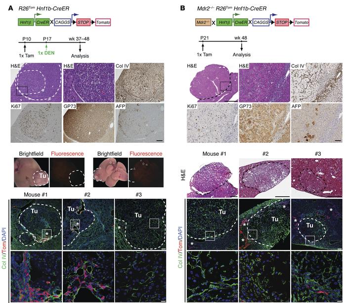 JCI - Lineage fate of ductular reactions in liver injury and carcinogenesis