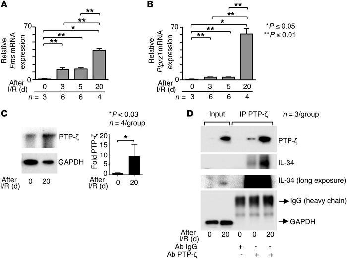 JCI - IL-34 mediates acute kidney injury and worsens subsequent chronic ...